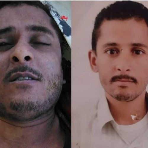 بوابة الحركات الاسلامية تصفيات جسدية وتعذيب وحشي تصاعد جرائم الحوثي
